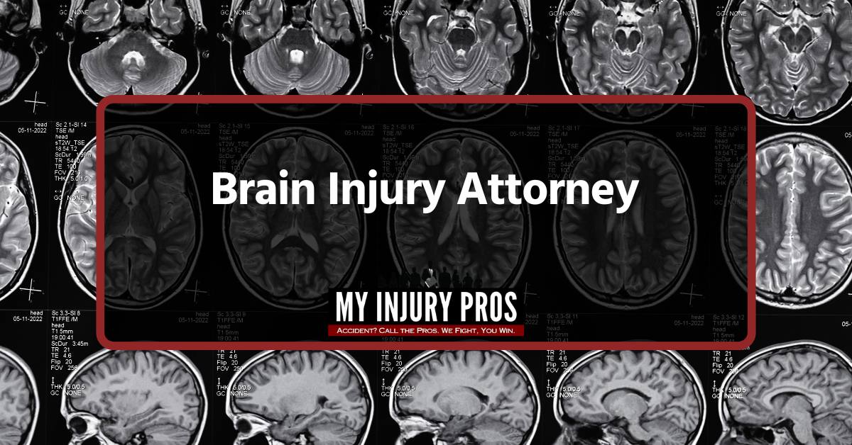 Brain Injury Attorney | My Injury Pros